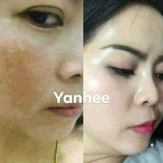 Yanhee 5in1 Purple Set With Box