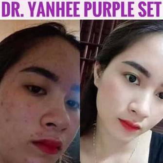 Yanhee 5in1 Purple Set With Box